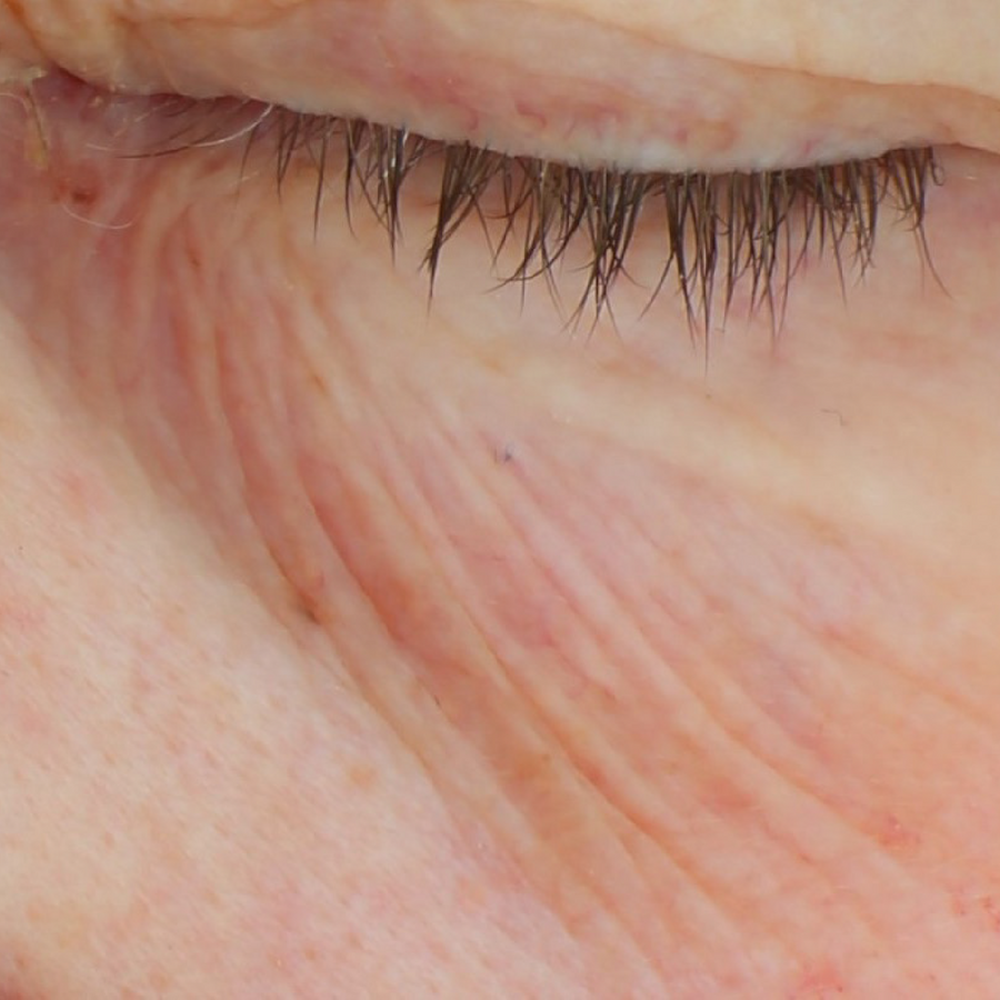 C+ Brightening Eye Complex | Revision Skincare®