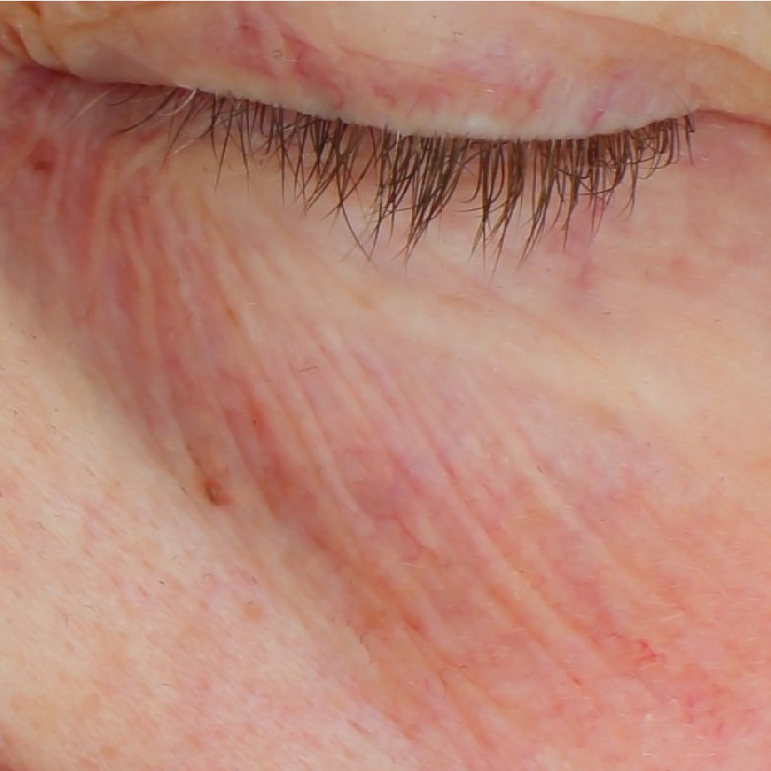 C+ Brightening Eye Complex | Revision Skincare®