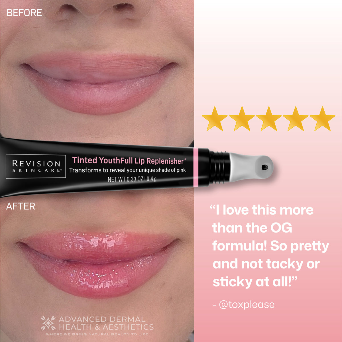 Tinted YouthFull Lip Replenisher® | pH-Activated Lip Plumper with ...