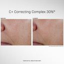 C+ Correcting Complex 30%™ | Revision Skincare®